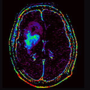 DCE-MRI Analysis | IB DCE